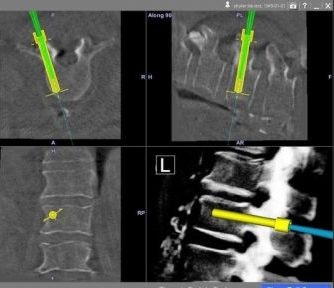 PONS Product Information and Latest Updates (2025) | Product Hunt